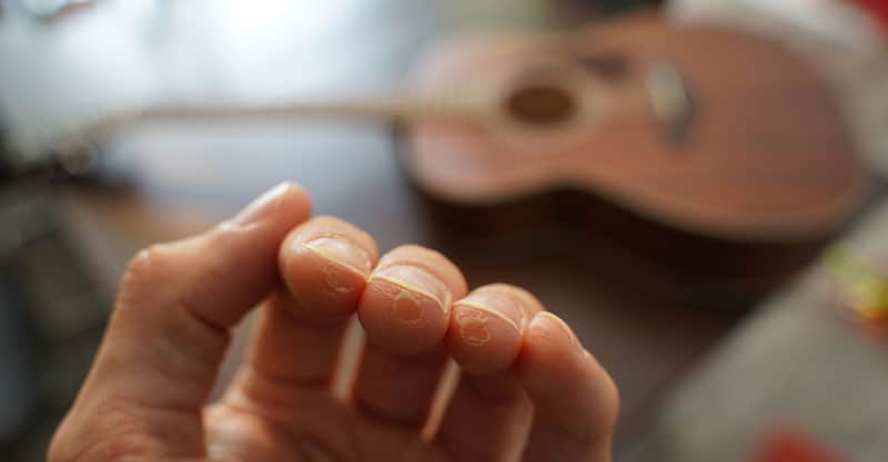 Guitar Calluses: 2 Best Recommendations & Helpful Guide